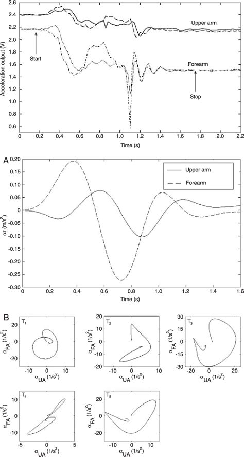 Figure 1 From Synergistic Control Of Forearm Based On Accelerometer Data And Artificial Neural
