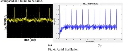 Figure 1 From Design And Development Of A Compact Real Time Ecg Device