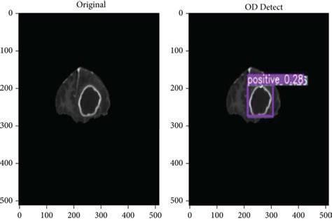Brain Tumor Detection Using Proposed Model Download Scientific Diagram