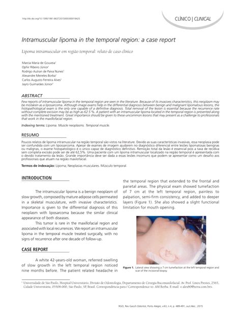 Pdf Intramuscular Lipoma In The Temporal Region A Case Report