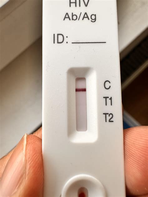 Could This Be A Positive Result R Hiv