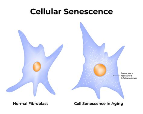Premium Vector Cellular Senescence Normal Fibroblast Cell Senescence