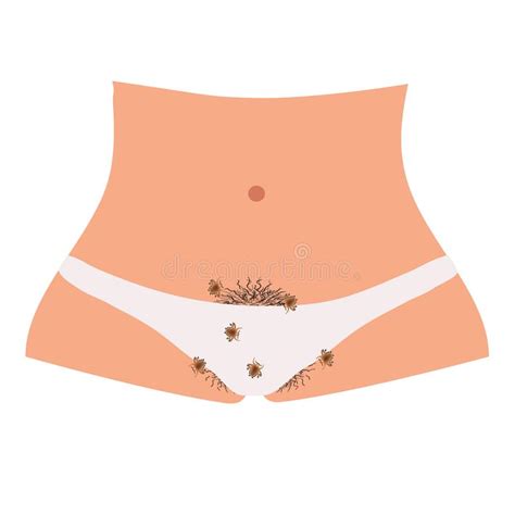 Parasitic Diseases Of Phthiriasis Pediculosis Pubis Pubic Lice
