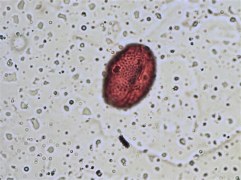 815766 1 Trifolium Noricum Global Pollen Project Global Pollen
