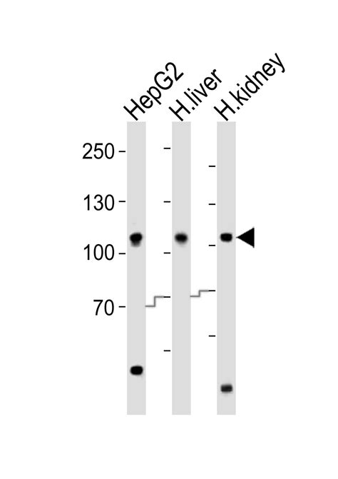 Mttp Antibody C Term Purified Rabbit Polyclonal Antibody Pab Wb