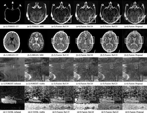 Figure 7 From Image Fusion Method Based On Structure Based Saliency Map