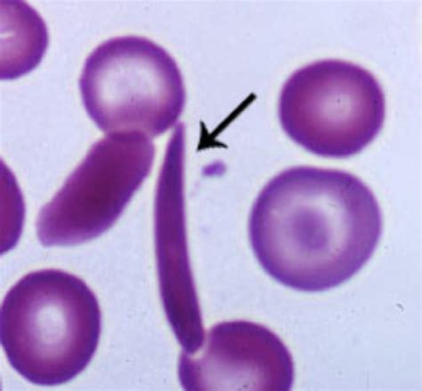 Plasmodium Spp Quizlet
