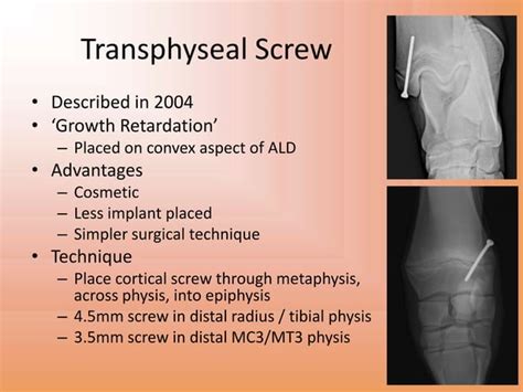 Angular Limb Deformity Ppt