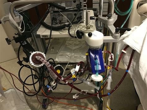 Crrt And Ecls Ecmo Resource A Space For Ecmo Specialists And Their Interdisciplinary Ecmo