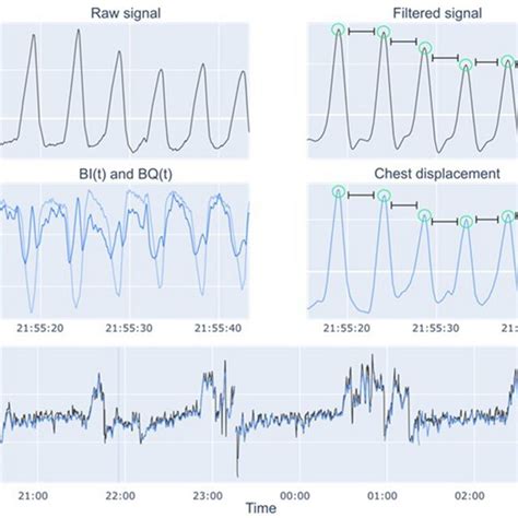 Respiratory Rate Estimates Of A Participant From Study Top Download Scientific Diagram