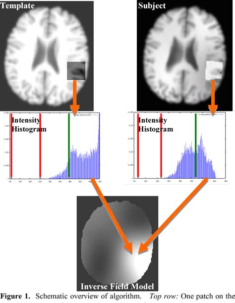 Figure 1 From Mri Non Uniformity Correction Through Interleaved Bias