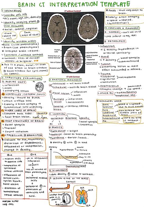 Brain Ct Scan Interpretation Templateskills Brainct Medicalstudent