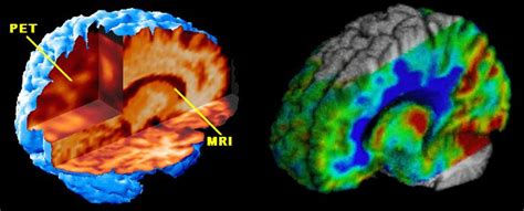 apollo medical imaging technology fusion