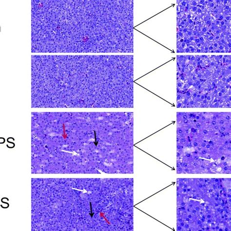 He Staining For Liver Tissues The Left Four Pictures Are In × 40