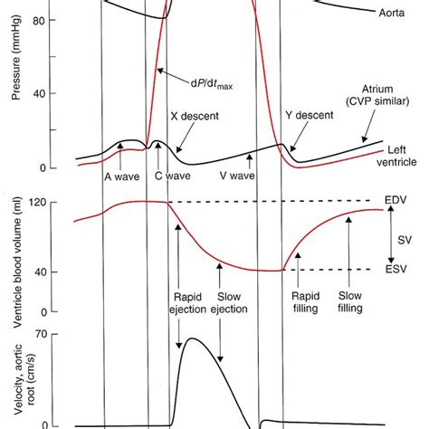 Example Of The Measurement Of Iso Volumic Relaxation Time Ivrt Ivrt