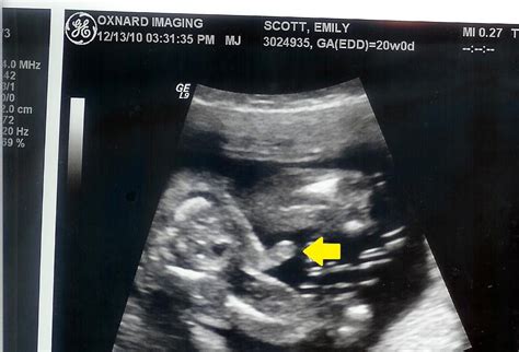 Dear Person Reading This Pornographic Ultrasound