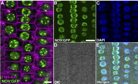 Nuclear Localization Of Novgfp Download Scientific Diagram