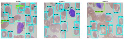 Object Detection With Model Garden Tensorflow Core