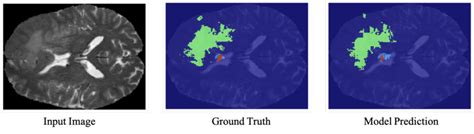 Qualitative Results Of Transdoubleu Net Wtgreenbluered Tcbluered