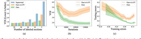 Figure 1 From Semi Supervised Neuron Segmentation Via Reinforced Consistency Learning Semantic
