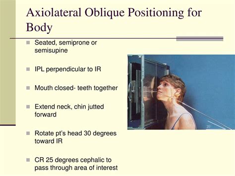 Ppt Mandible And Tmj Lecture Powerpoint Presentation Free Download Id 292789