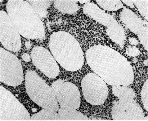 Figure I From Cold Vasculitis Semantic Scholar