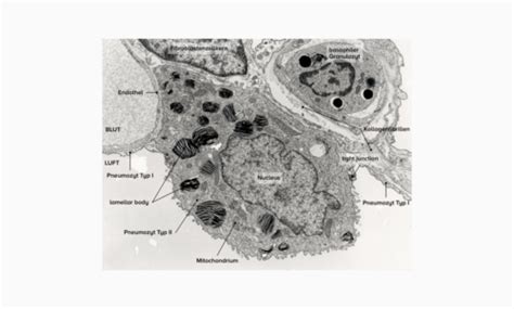 Tem Bilder Flashcards Quizlet