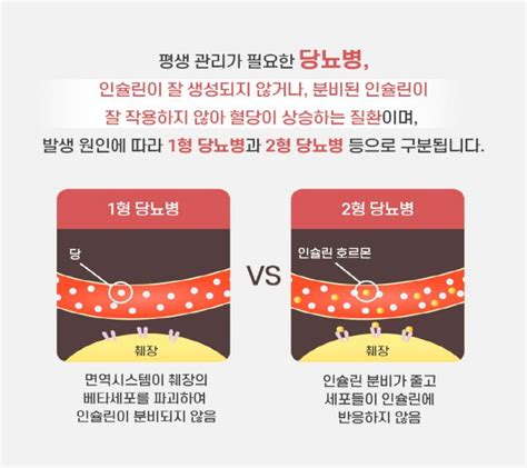 1형 당뇨 2형 당뇨 변화시키려면 진기하게