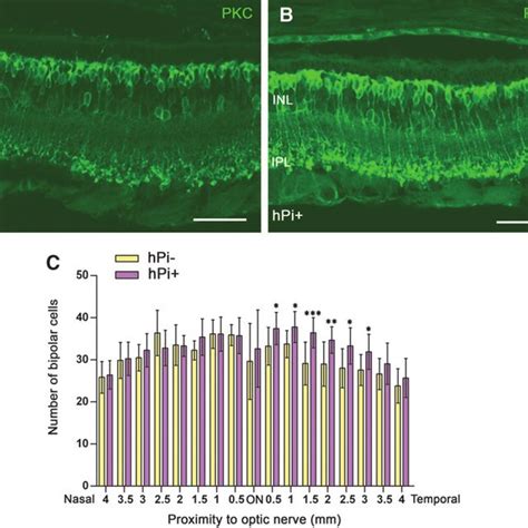 Synaptic Connectivity In Outer Plexiform Layer Opl And Rod Bipolar