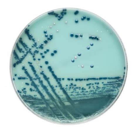 Detection Of Carbapenem Resistant Enterobacteriaceae Scientist Live