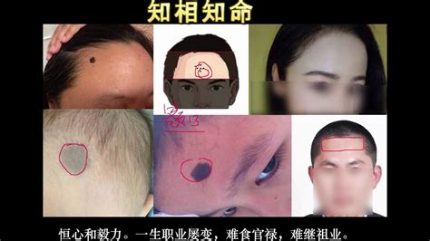 面相之额相系列13额头上斑疹肉瘤胎记色泽和气色的凶吉好坏 YouTube