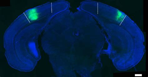 Visual Recognition Memory Picower Institute