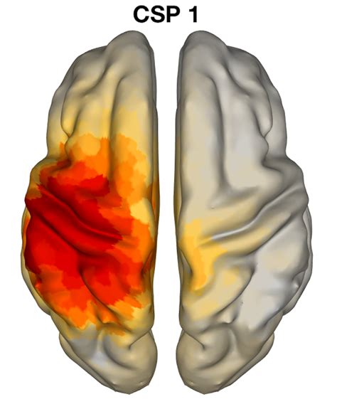 Eloreta Localization Of Csp Patterns Presented In Figure 5 With Download Scientific Diagram