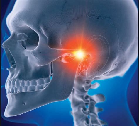 Prek Nyjet E Nofullës Sindroma Costen Shkaqet Simptomat Dhe Trajtimi Me Mjekun