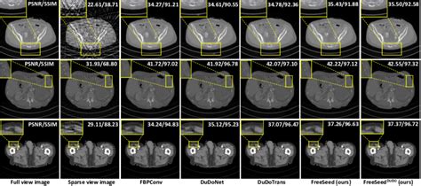 Visual Comparison Of State Of The Art Methods From Top To Bottom Download Scientific Diagram