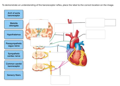 Solved To Demonstrate An Understanding Of The Baroreceptor