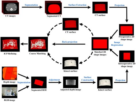 The Workflow Of The Proposed Markerless Registration Method Download Scientific Diagram