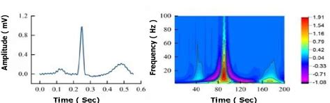 Figure 3 From A Hybrid Deep Learning Approach For Ecg Based Arrhythmia Classification Semantic