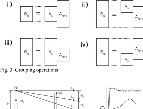 Figure 1 From Morphological Classification Of St Segment Using Reference Sts Set Semantic Scholar