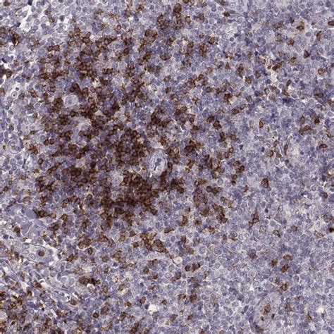 Mouse Monoclonal Anti Cd8a Antibody Buy For Research Highly