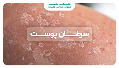 سرطان پوست چیست؟ پیشگیری، درمان و علائم سرطان پوست