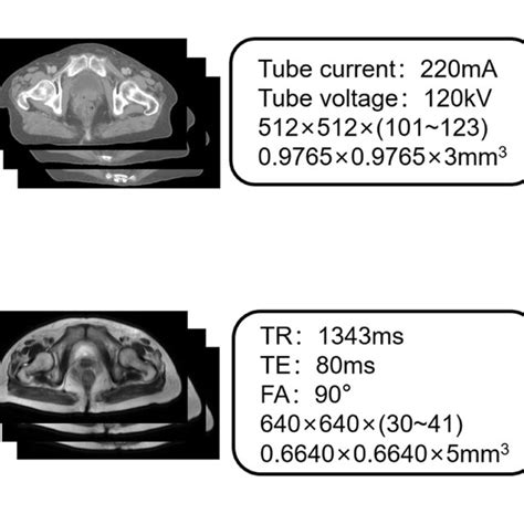 Flowchart Of Ct And Mri Image Data Acquisition And Preprocessing