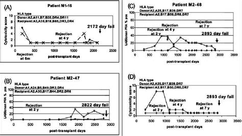 Examples Of Patients With Hla And Mica Antibodies That Did Not Increase