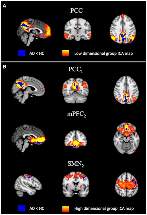 Between Group Differences In Resting State Network Rsn Spatial Maps Download Scientific