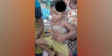 စစ်တပ်က လက်နက်ကြီးပစ်ခတ်မှုကြောင့် မြောက်ဦး မောင်းဆွဲရွာက ကလေး ၂ ဦး ဒဏ်ရာရ