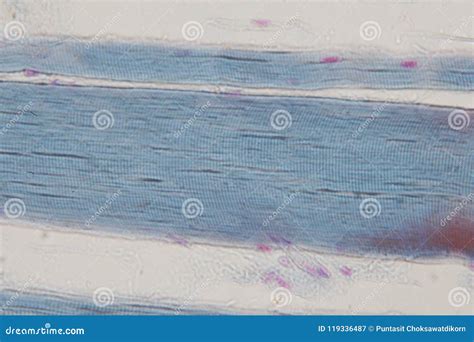 Human Skeletal Muscle Under Microscope View For Education Histology