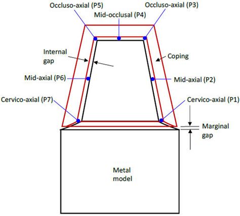 Schematic Presentation Of Marginal And Internal Gaps In Metal Download Scientific Diagram