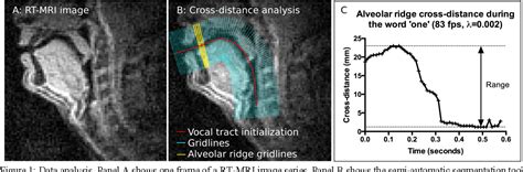 Figure 1 From Sensitivity Of Quantitative Rt Mri Metrics Of Vocal Tract Dynamics To Image