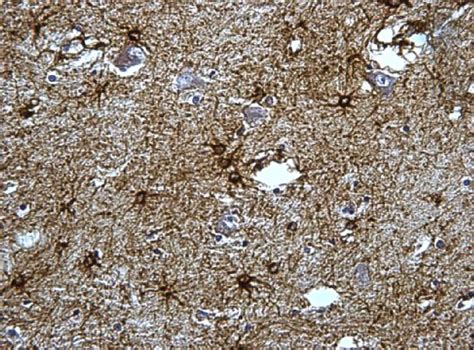 Anp 336 Cerebral Cortex Astrocytes With Augmented Activity And Size Download Scientific