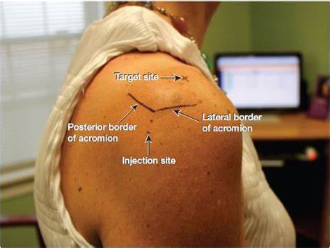 Upper Extremities Musculoskeletal Key